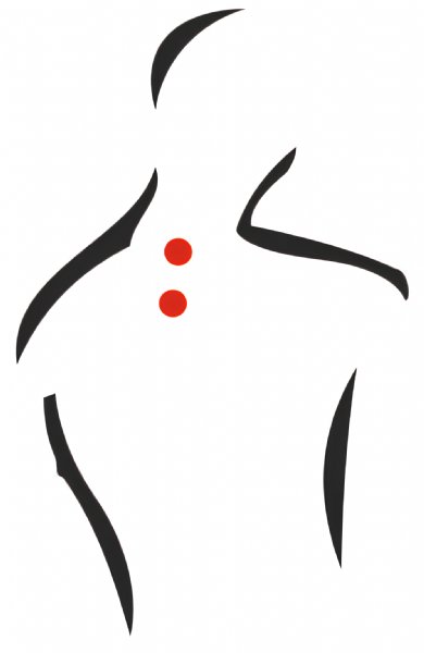 Hijama London, London | Healthcare Service Provider - FreeIndex